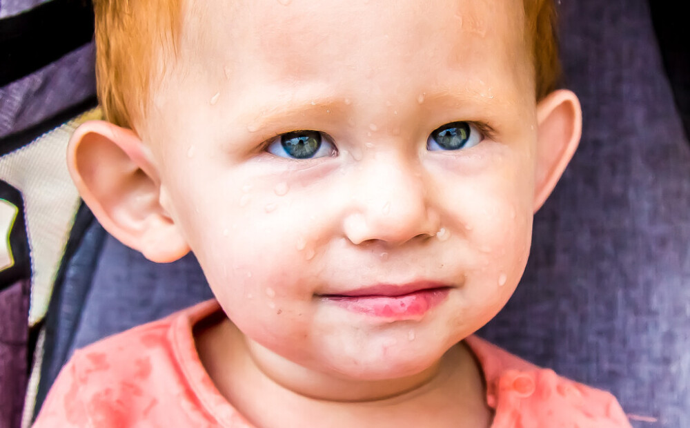 Atšļukušas ausis? Kad ir vispiemērotākais laiks tās operēt