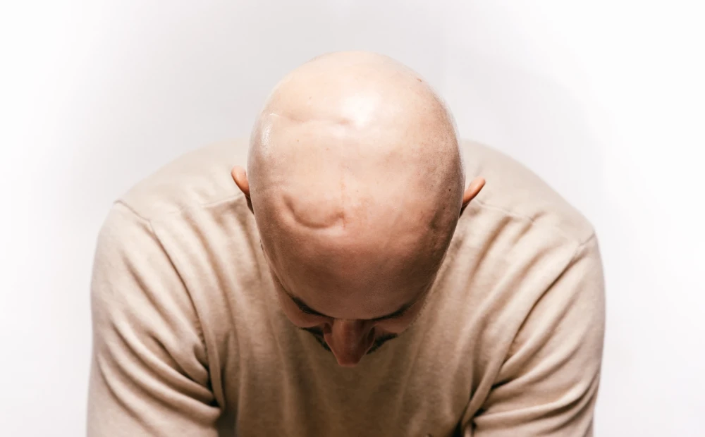 Onkoloģisku slimību simptomi, kurus iespējams pamanīt agrīni pašu spēkiem