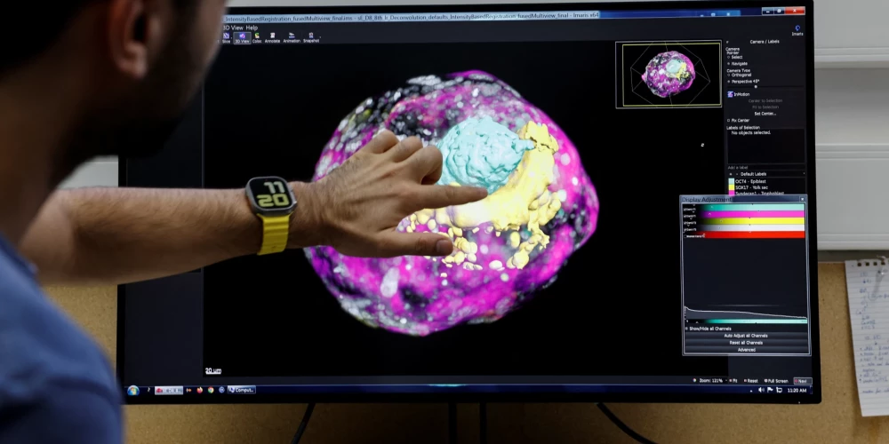 Nevainīgā ieņemšana: laboratorijā rada cilvēka embriju