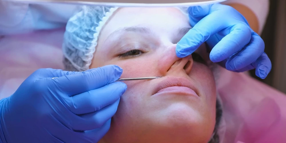 "Nāves trīsstūris" - ārsts rezidents TikTok platformā izstāsta, kurā ...